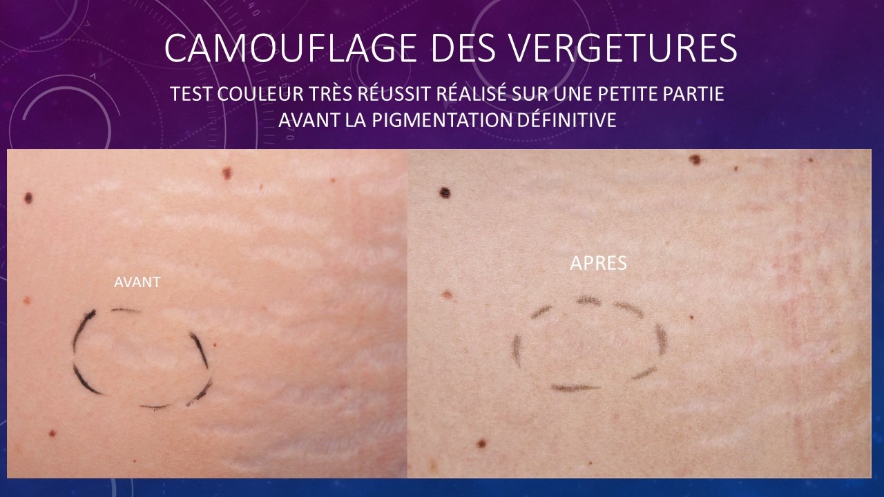 RIDES & CICATRICES - Ysabel Marignan